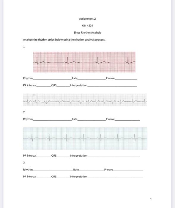 2. Rhythm Rate P wave PR interval QRS Interpretation. | Chegg.com