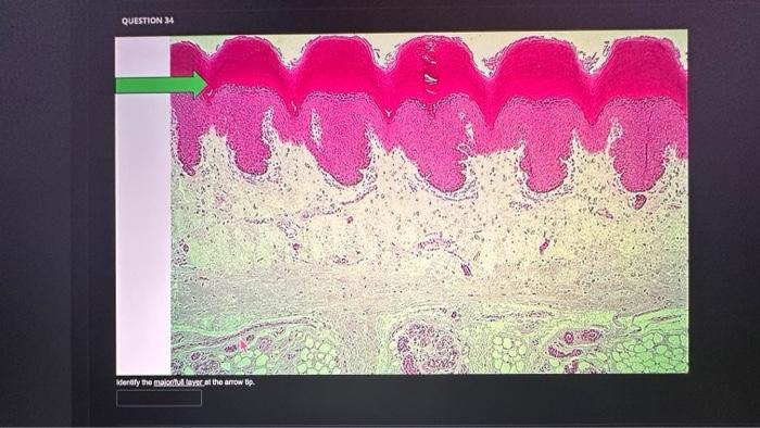 Solved identify the major/full layer at the arrow tip | Chegg.com