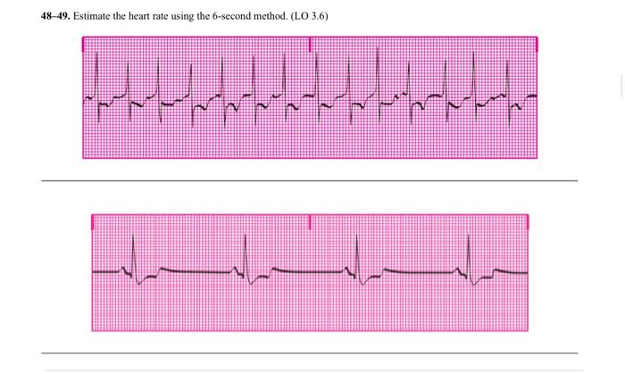 Solved 48-49. Estimate the heart rate using the 6-second | Chegg.com