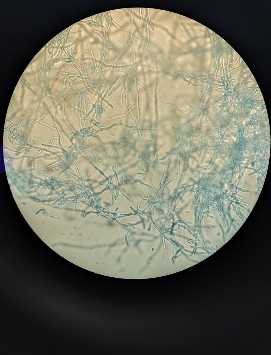 Solved Based on these images, is the sample Candida spp? The | Chegg.com