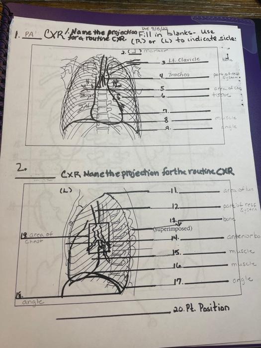 Solved 1. PA CXR /. Name the projeothoo Fill in blanks- Use | Chegg.com