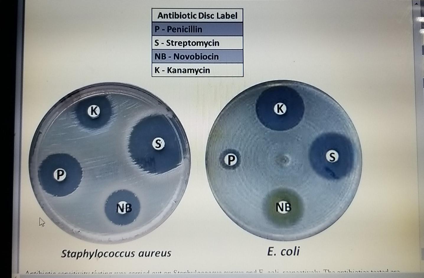 Solved Antibiotic Disc Label P-Penicillin S-Streptomycin NB | Chegg.com