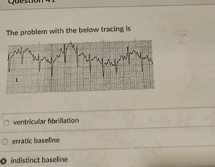 Solved by an EXPERT The problem with the below tracing isventricular ...