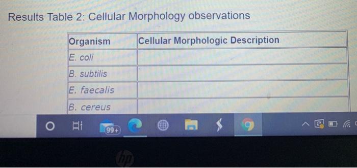 Solved Negative stain slides: You will see the name of the | Chegg.com