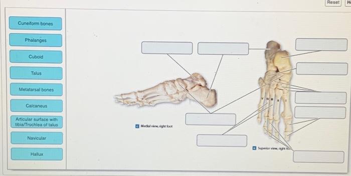Solved Cuneiform bones Phalanges Cuboid Talus Metatarsal | Chegg.com