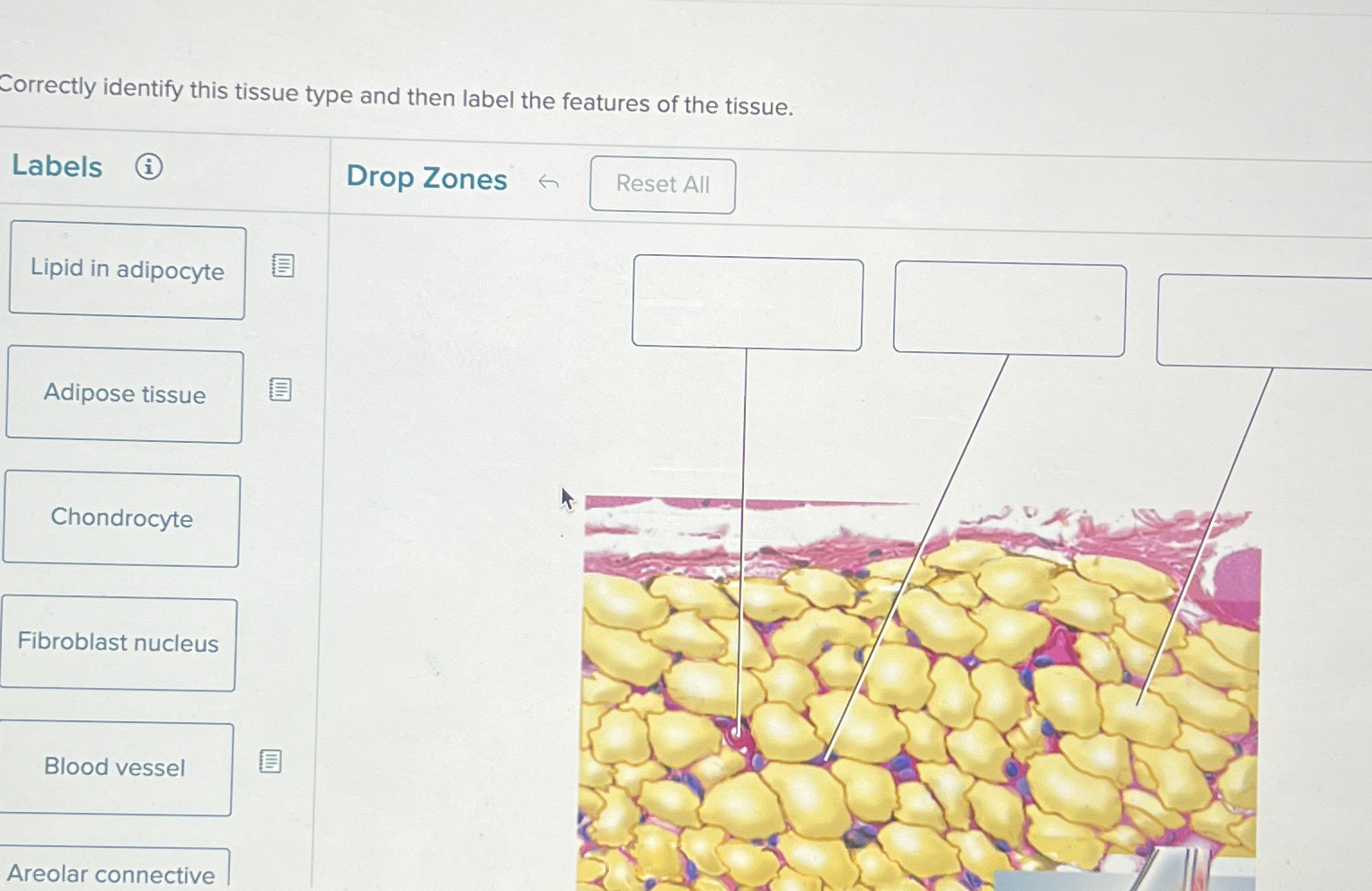 Solved Correctly identify this tissue type and then label | Chegg.com