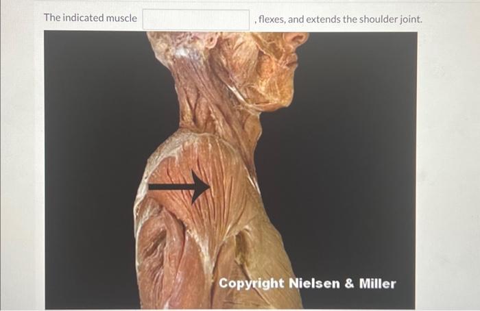 Solved The indicated muscle , flexes, and extends the | Chegg.com