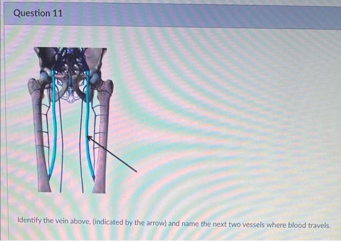 Solved Question 11 Identify the vein above, (indicated by | Chegg.com