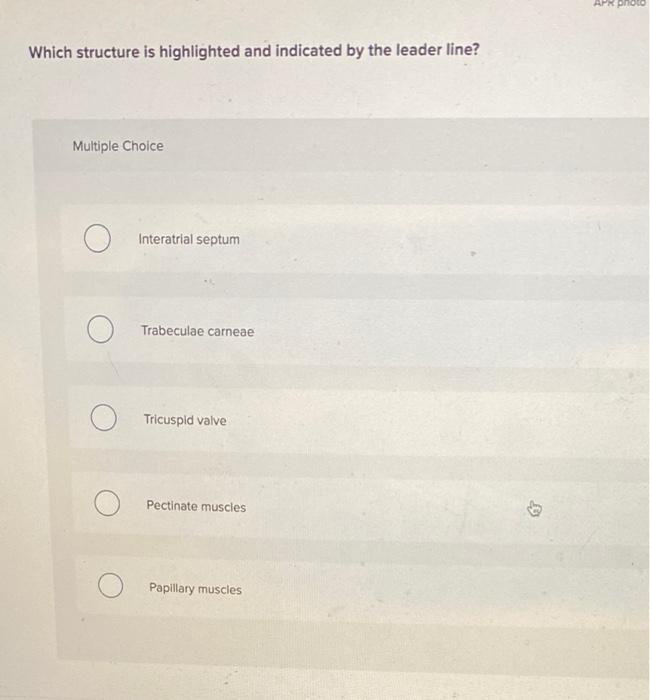 Solved 0 APR photo McHucation Which structure is highlighted | Chegg.com