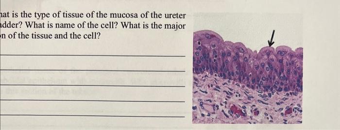 Solved what is the type of tissue of the mucosa of the | Chegg.com