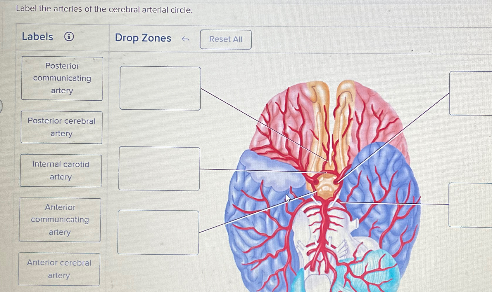 Solved Label the arteries of the cerebral arterial | Chegg.com