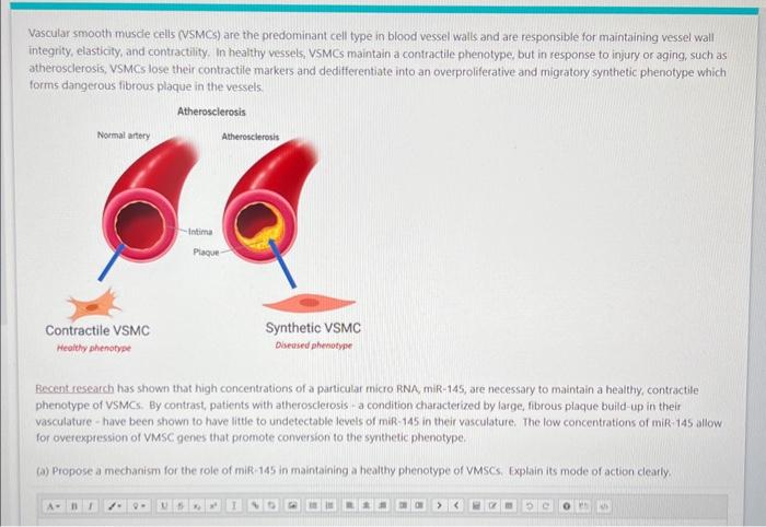Solved Vascular smooth musce celis (VSMCS) are the | Chegg.com