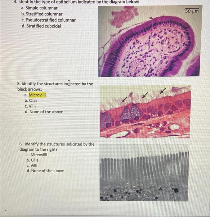 Solved 1. Identify the type of epithelium indicated by the | Chegg.com