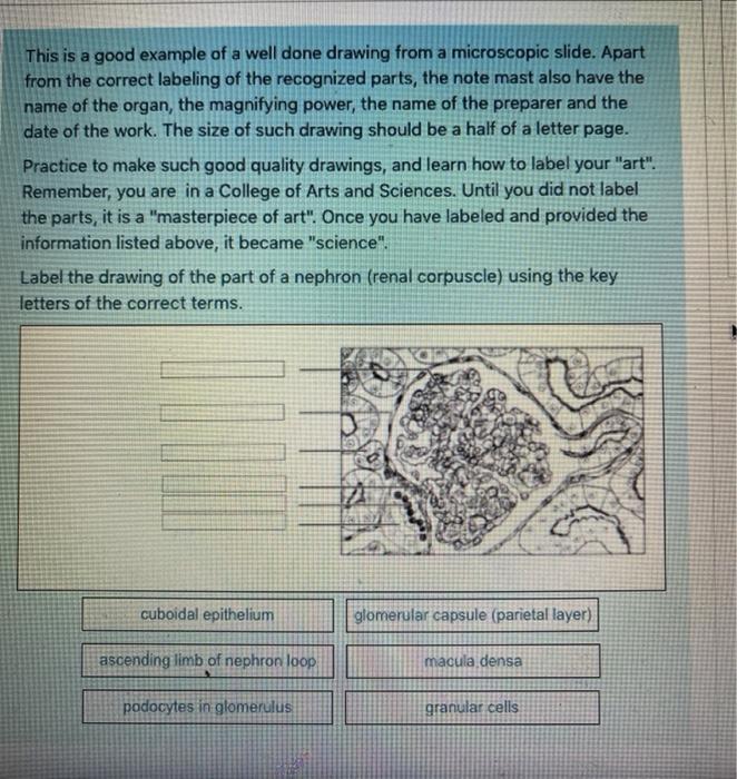 Solved C B А. vo D WIP Filtration slit w slit membrane | Chegg.com