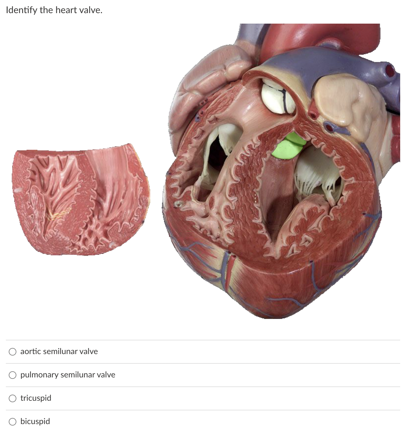 Solved Identify the heart valve.aortic semilunar | Chegg.com Solved Identify the heart valve.aortic semilunar | Chegg.com