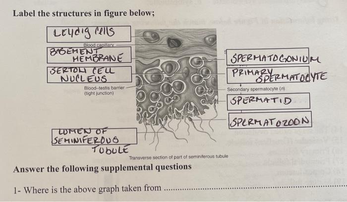 Solved Label the structures in figure below; Leydig cells | Chegg.com