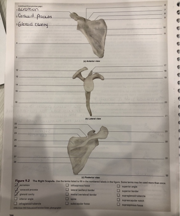 Solved from previous for acromion 2Coracoid process Glenoid | Chegg.com