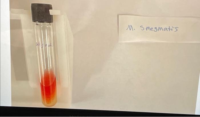 Solved PART B: Methyl Red Test and Voges-Proskauer Test | Chegg.com
