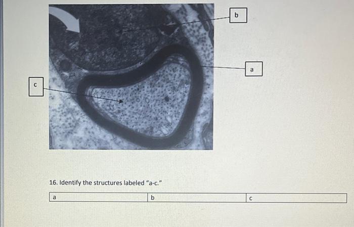 Solved 16. Identify the structures labeled "a-c." | Chegg.com