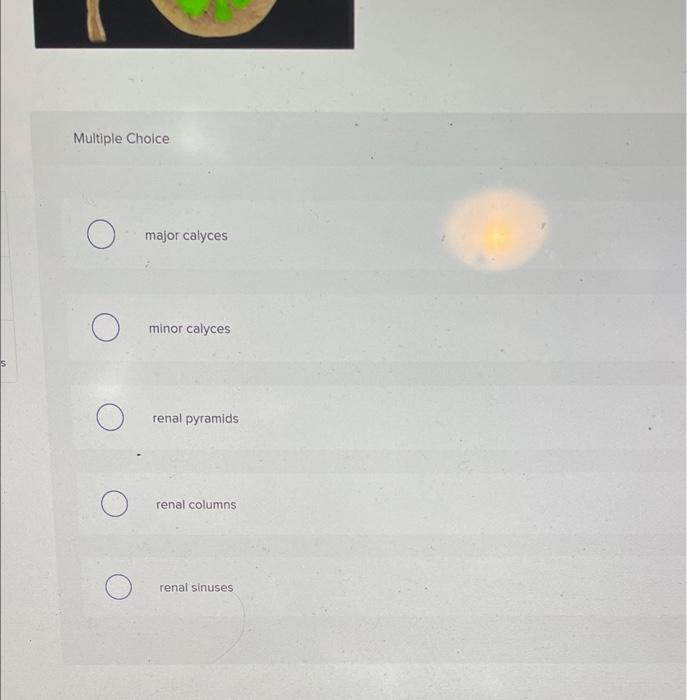 Solved Which Structure Is Highlighted Multiple Choice