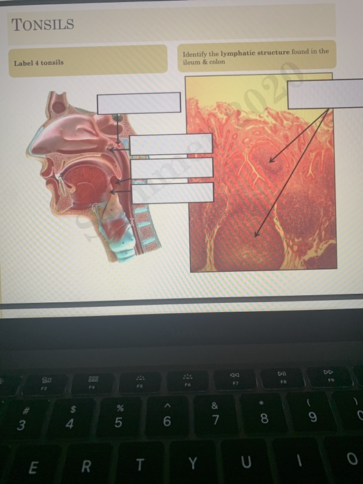 Solved TONSILS Identify the lymphatic structure found in the | Chegg.com