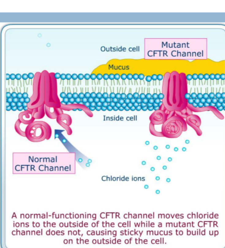 Solved A normal-functioning CFTR channel moves chlorideions | Chegg.com