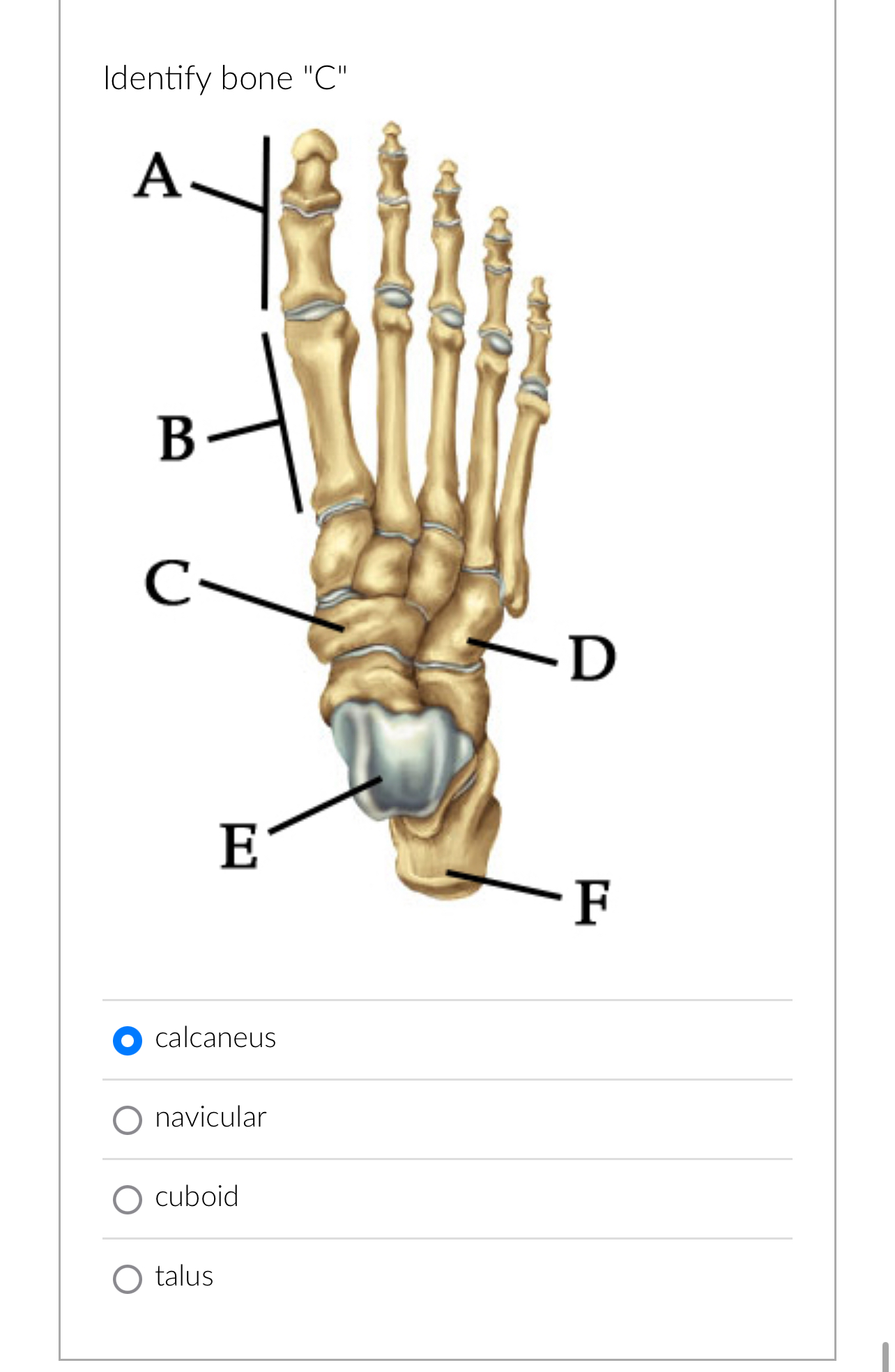 Solved Identify bone "C"calcaneusnavicularcuboidtalus | Chegg.com