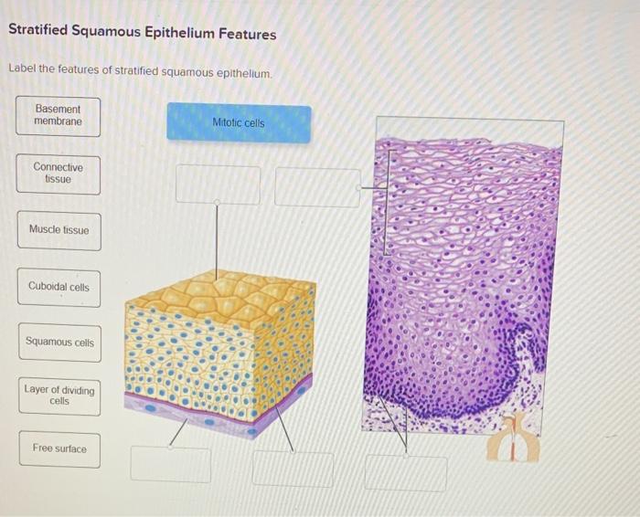 Solved Stratified Squamous Epithelium Features Label the | Chegg.com