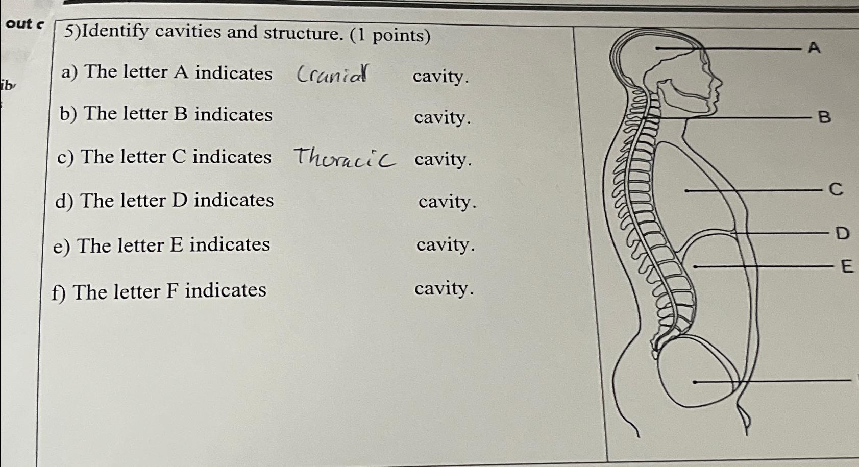 Solved Identify cavities and structure. (1 ﻿points)a) ﻿The | Chegg.com