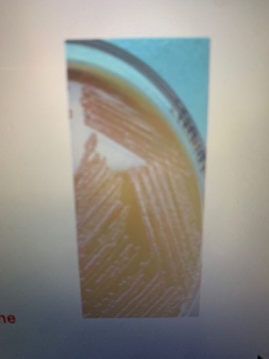 Solved What do the growth and appearance of the colonies on | Chegg.com
