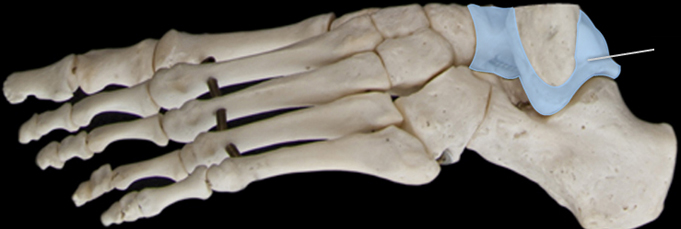 Solved Which bone is highlighted in blue?Question 18 | Chegg.com