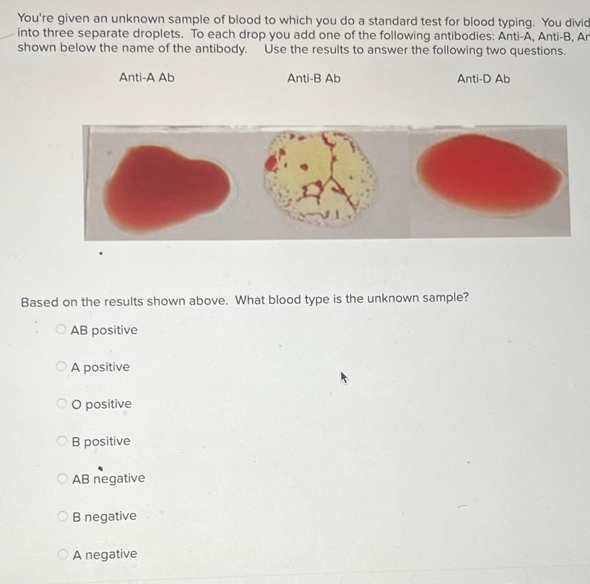 You're given an unknown sample of blood to which you | Chegg.com