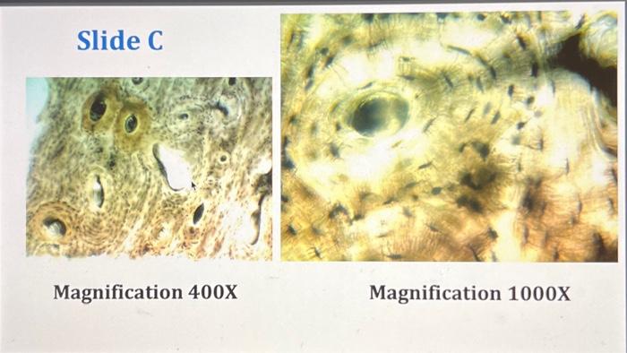 Solved Slide F Magnification 1000X Hint: this is not an | Chegg.com