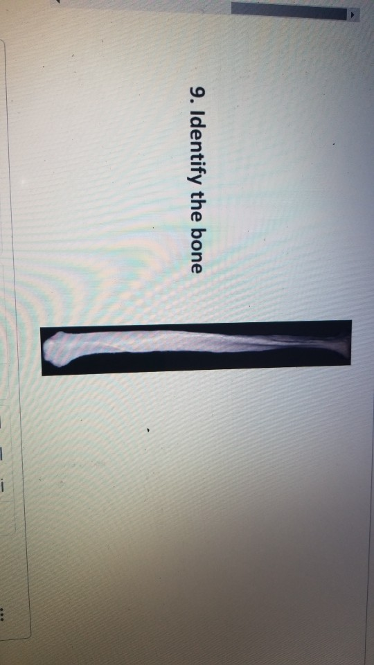 Solved 9. Identify the bone - 10. Identify the bone 11. | Chegg.com