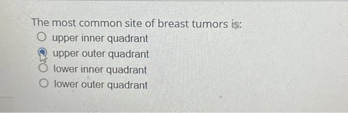 Solved The most common site of breast tumors is: O upper | Chegg.com