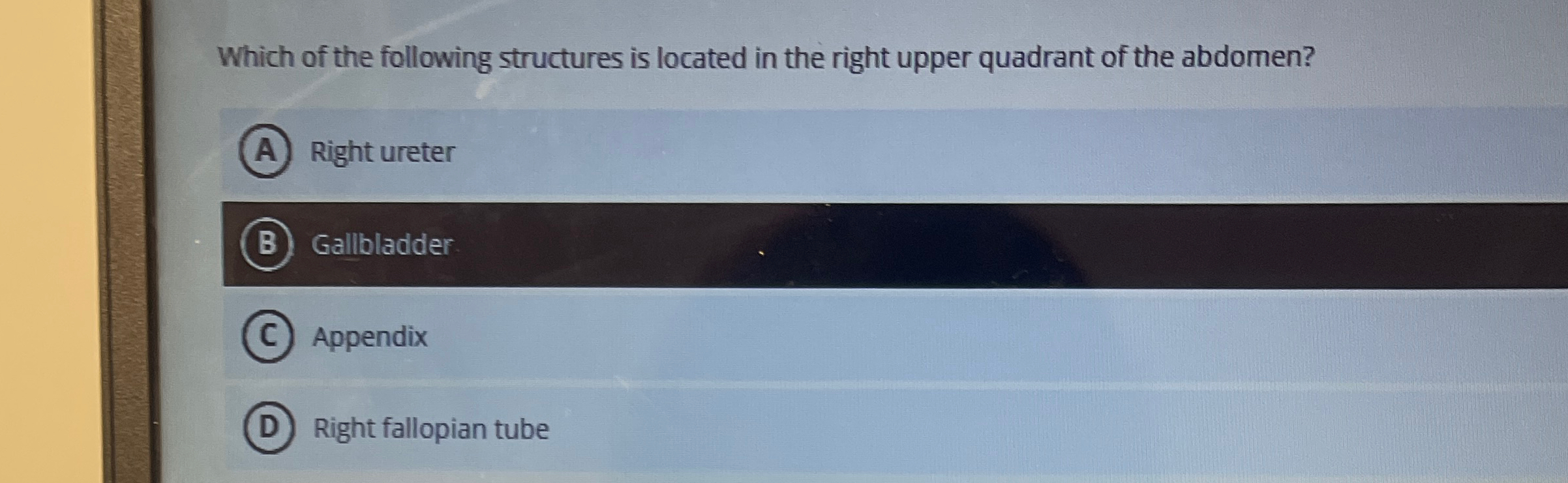 Solved Which of the following structures is located in the | Chegg.com