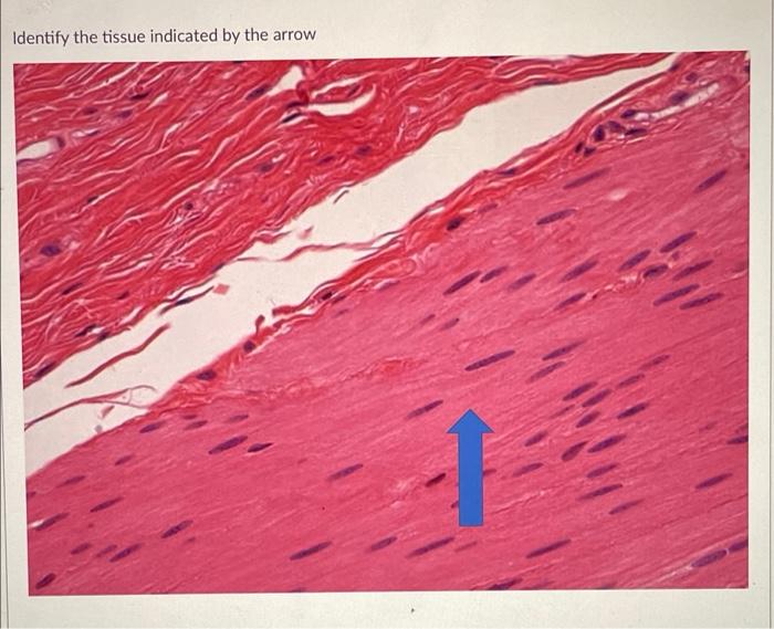Solved Identify the tissue at the pointer Identify the | Chegg.com