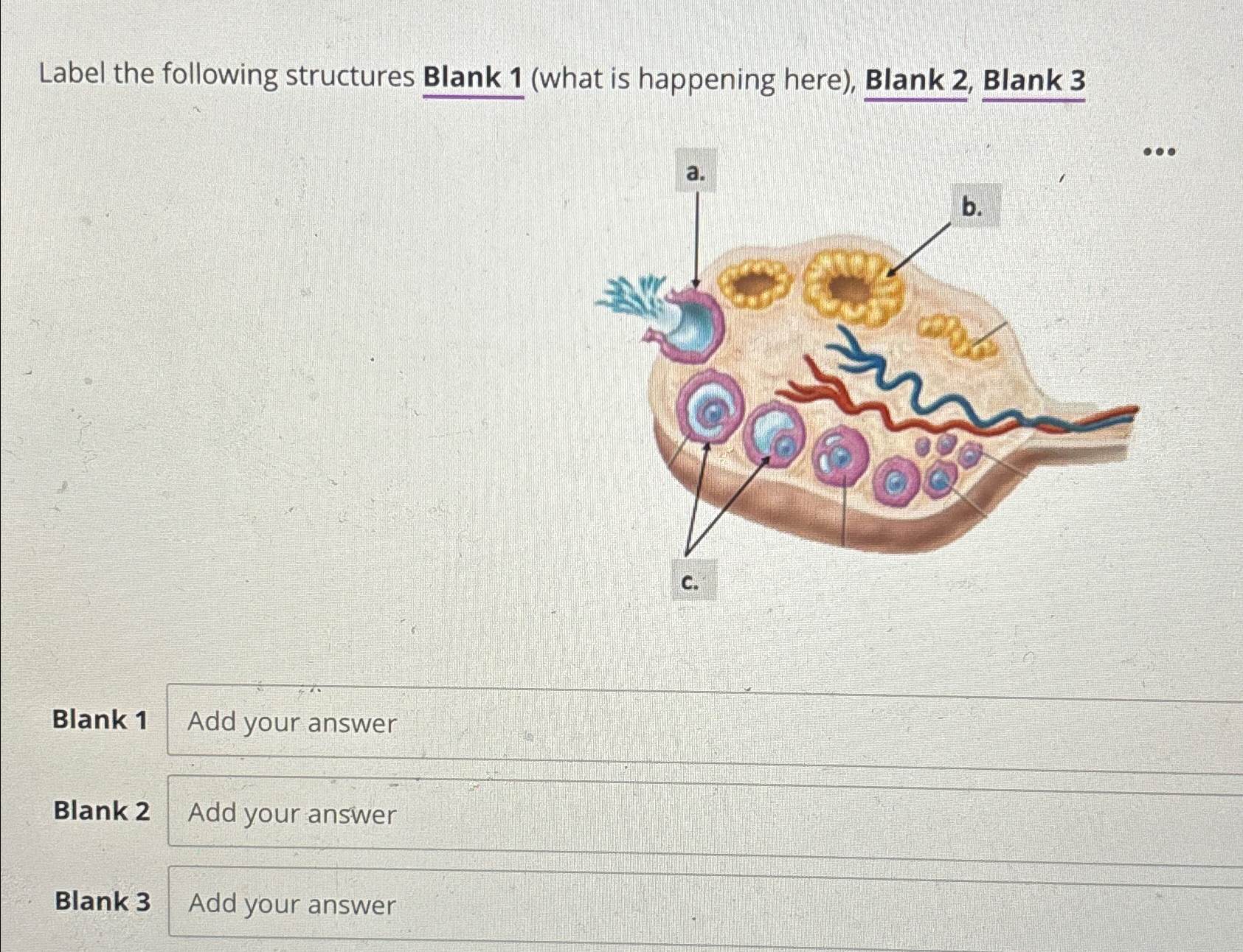 Solved Label the following structures Blank 1 (what is | Chegg.com