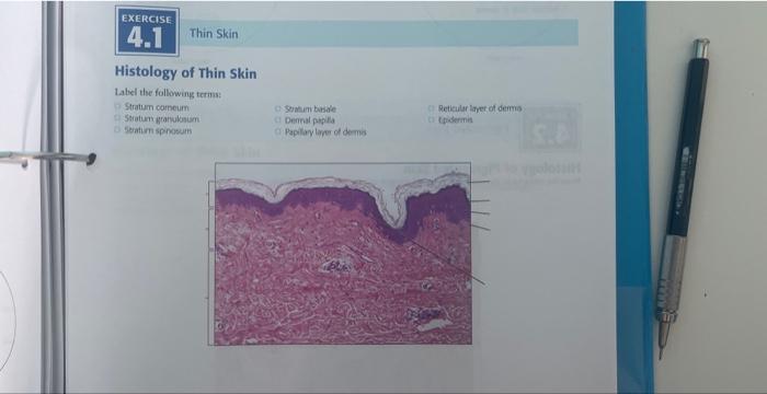 Solved Histology of Thin Skin label the following terms: | Chegg.com