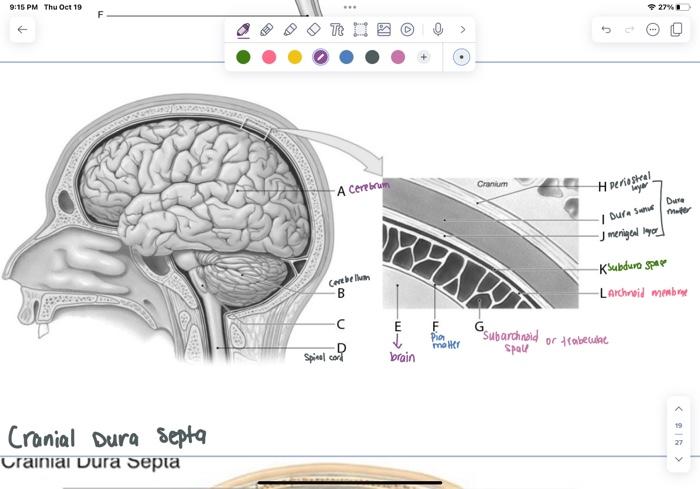 Solved Cranial Dura Septa Urainlai vura septa | Chegg.com