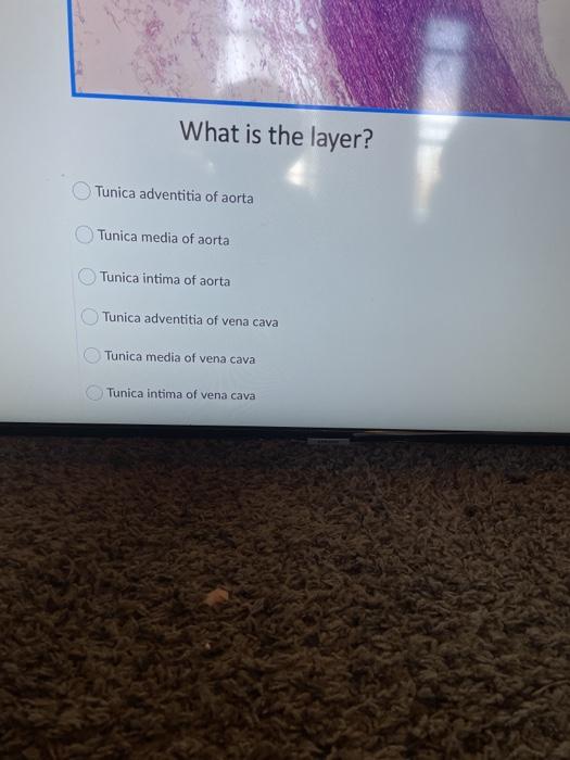 Solved What is the layer? Tunica adventitia of aorta Tunica | Chegg.com