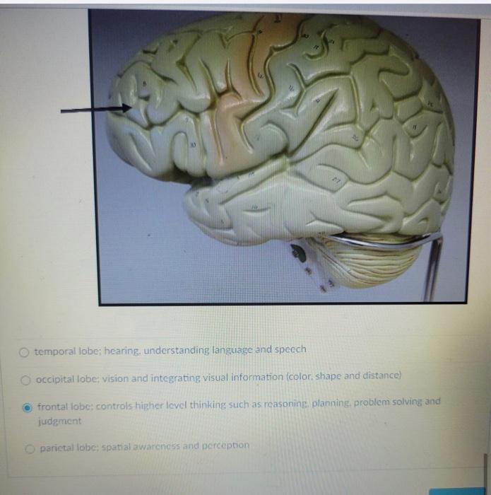 Solved Identify the structure at the tip of the pointer and | Chegg.com