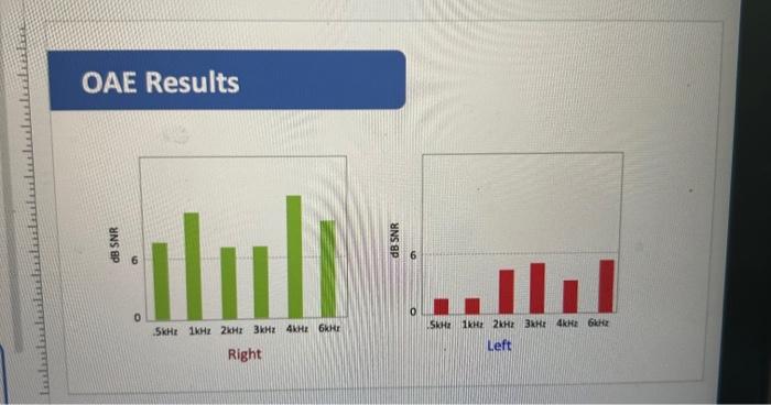 Audiology question. What would this OAE bar graph | Chegg.com