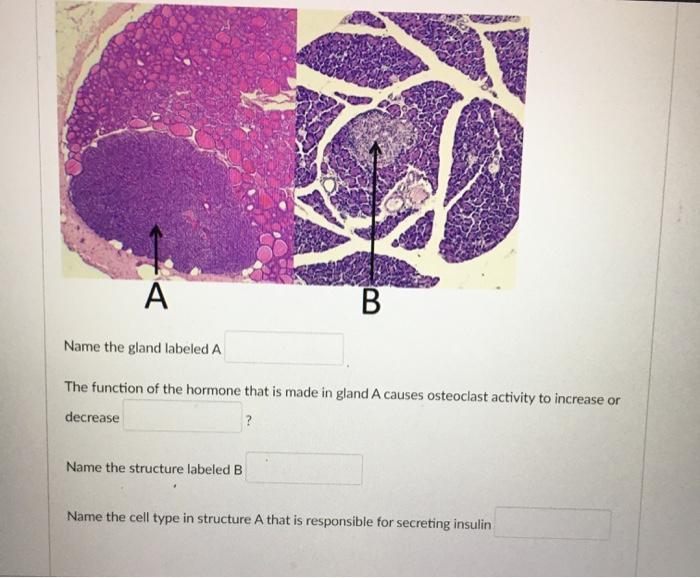 Solved С 3L B A. D Name the pouch-like structure labeled A | Chegg.com