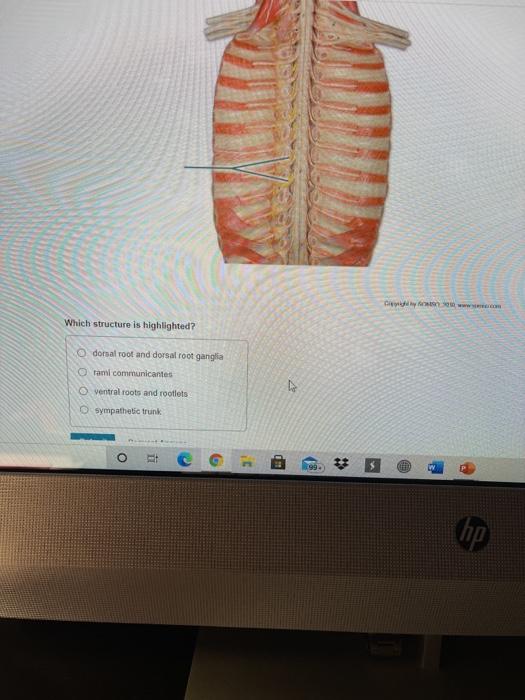 Solved Which structure is highlighted? dorsal root and | Chegg.com