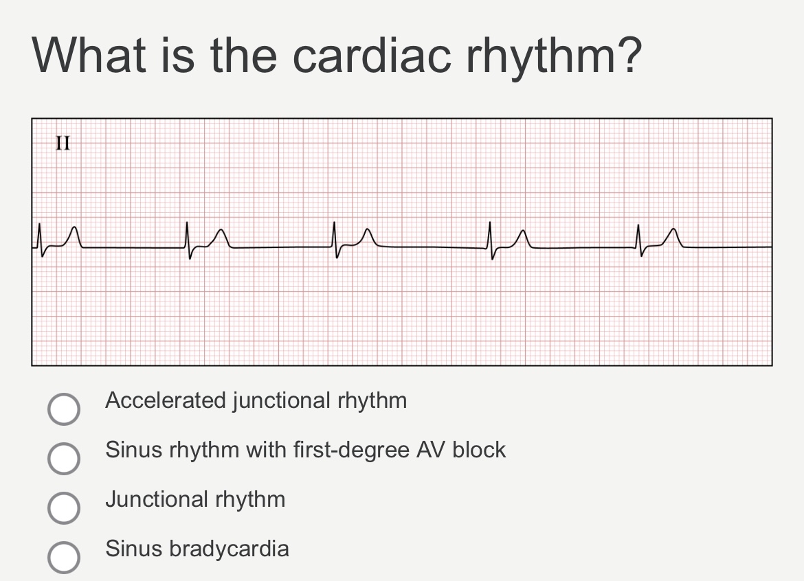 Solved What is the Cardiac Rhythm? ﻿Choose from Multiple | Chegg.com