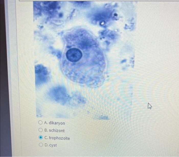 Solved A. dikaryon B. schizont C. trophozoite | Chegg.com