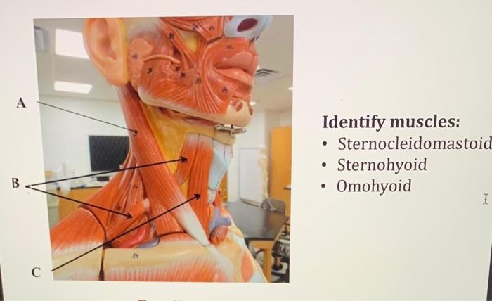 Solved Identify muscles: - Sternocleidomastoid - Sternohyoid | Chegg.com