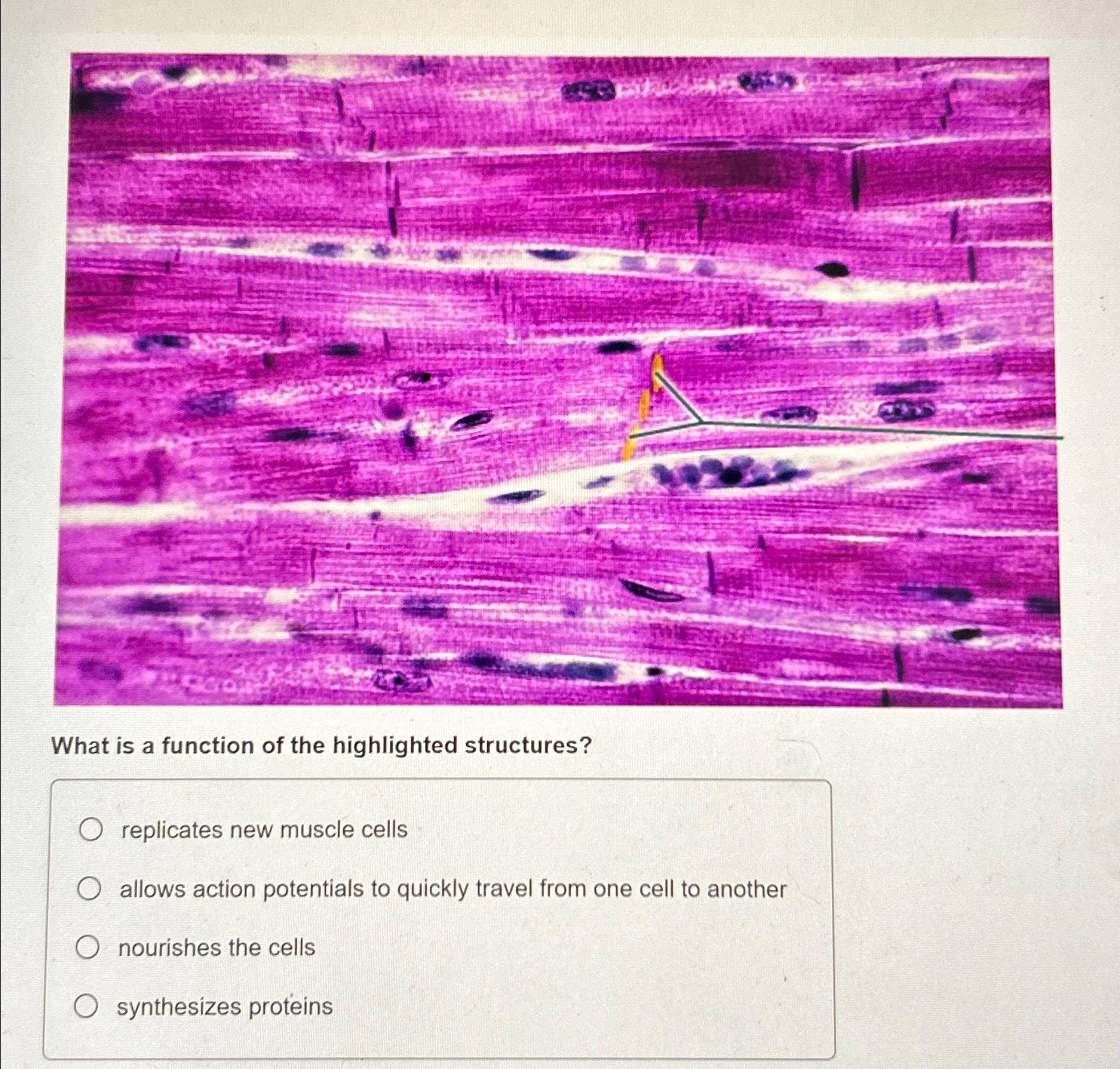 Solved What is a function of the highlighted | Chegg.com