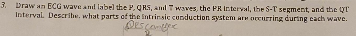 Solved Draw an ECG wave and label the P, QRS, and T waves, | Chegg.com